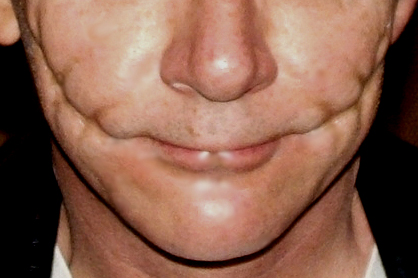 Flexible Collodion Makeup - Mugeek Vidalondon